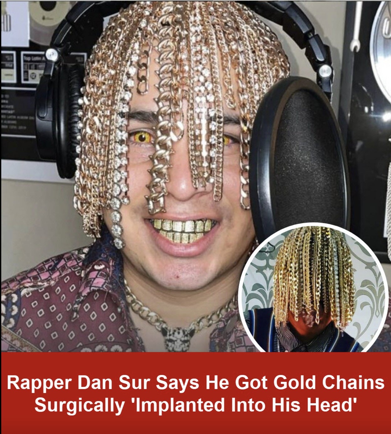 Rapper had surgery to get gold chains implanted into his skull - Spirit ...